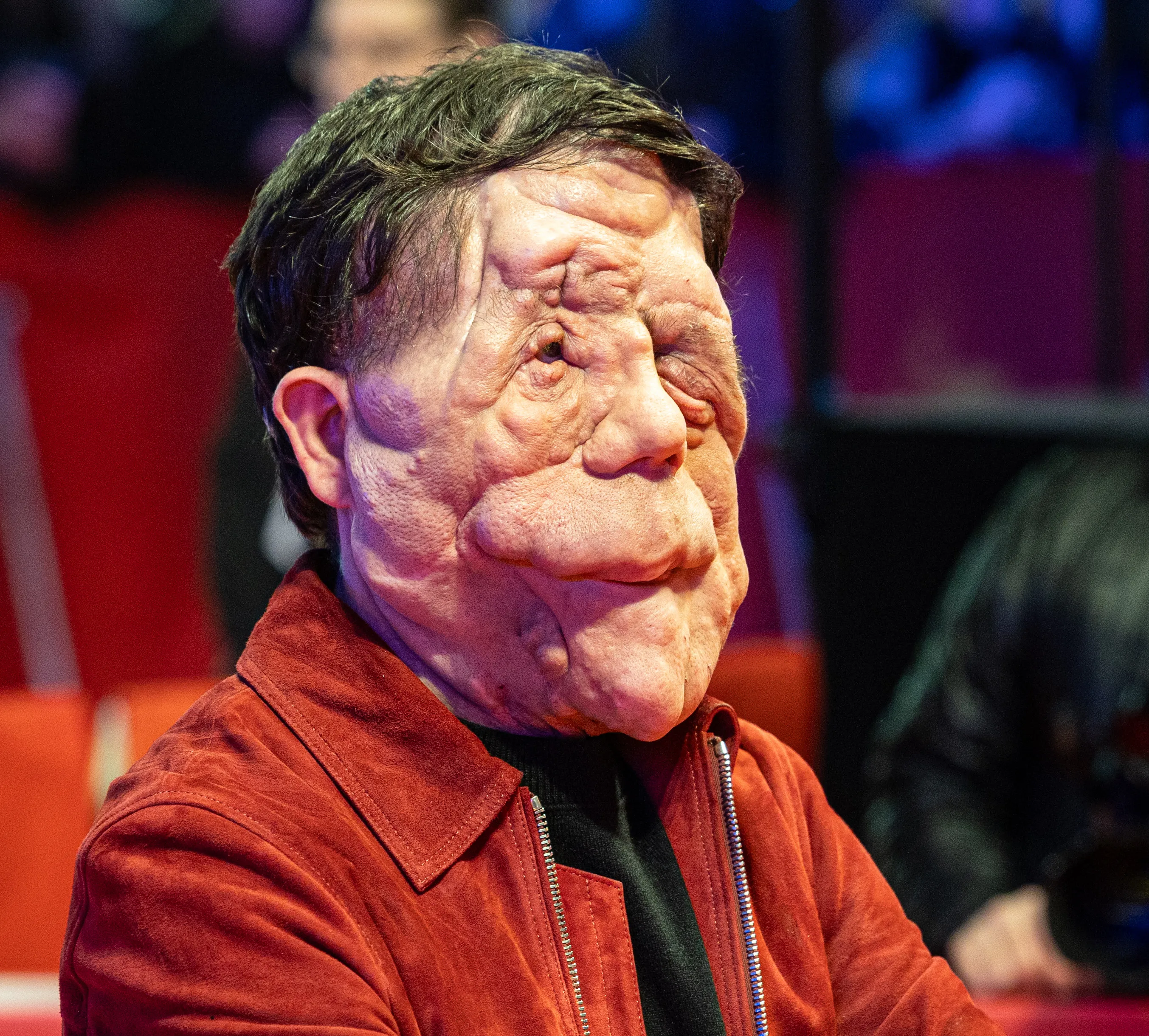 A Different Man’s Adam Pearson to Star in The Elephant Man Film ...